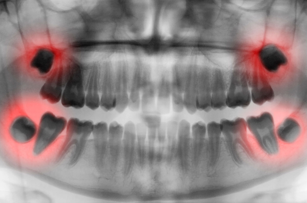 TAC Dental en Getafe - Clínica Dental Loyola